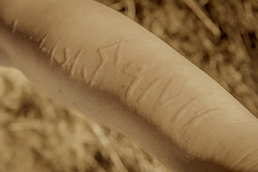 Dermatographia | Unsettling Stories